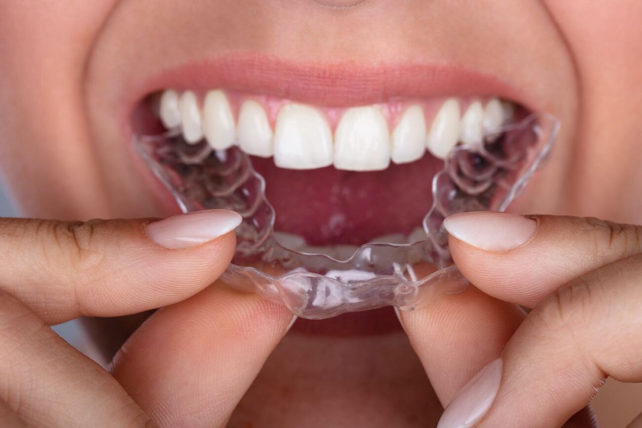 Proper Hygiene with Invisalign - Dentists in Annapolis, MD